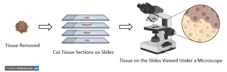 A Mohs Surgeon Explains the Procedure - AIM at Skin Cancer Foundation